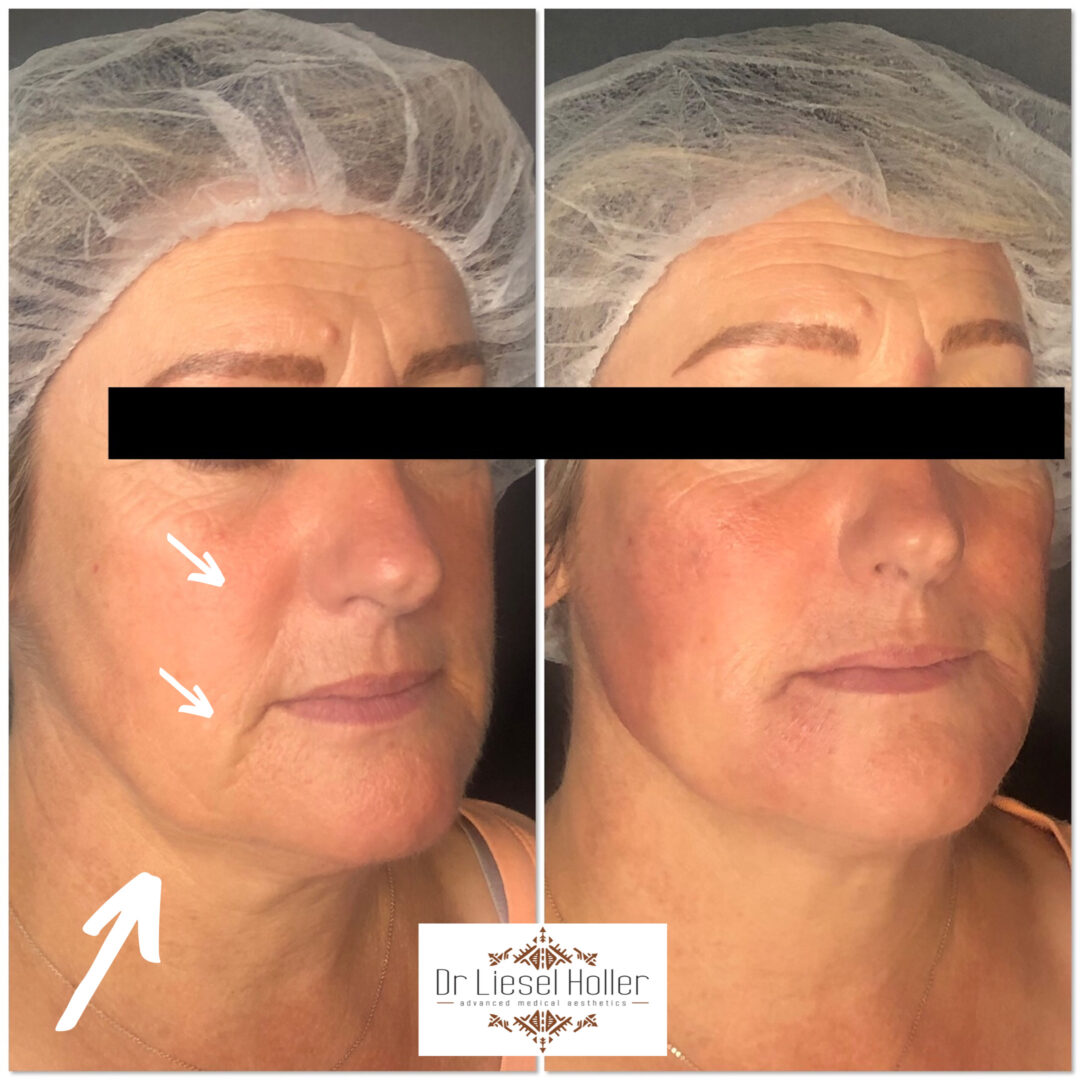 Dr Liesel Holler Advanced Medical Aesthetics - Visit Chislehurst